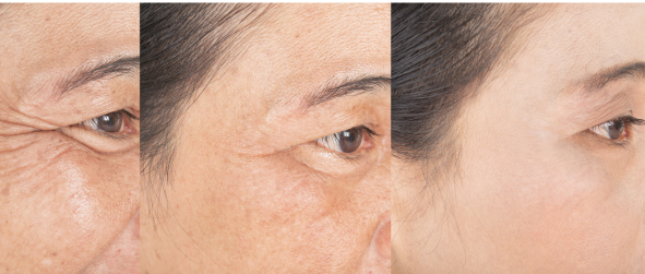 LED LIGHT THERAPY FOR REVITALIZING DULL, AGING SKIN – SkinImpact LED