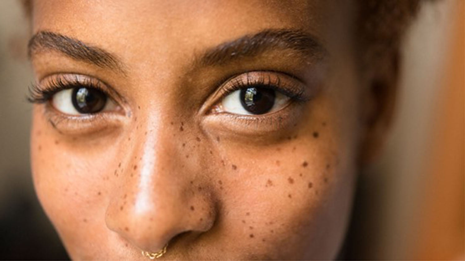 HOW BLUE LED LIGHT HELPS IN COMBATING ACNE – SkinImpact LED