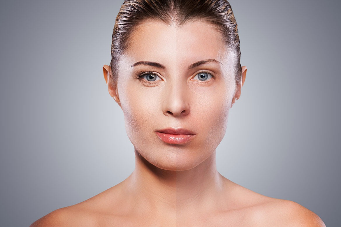 EVALUATING THE ROLE OF LED THERAPY IN REDUCING ACNE AND BLEMISHES ...